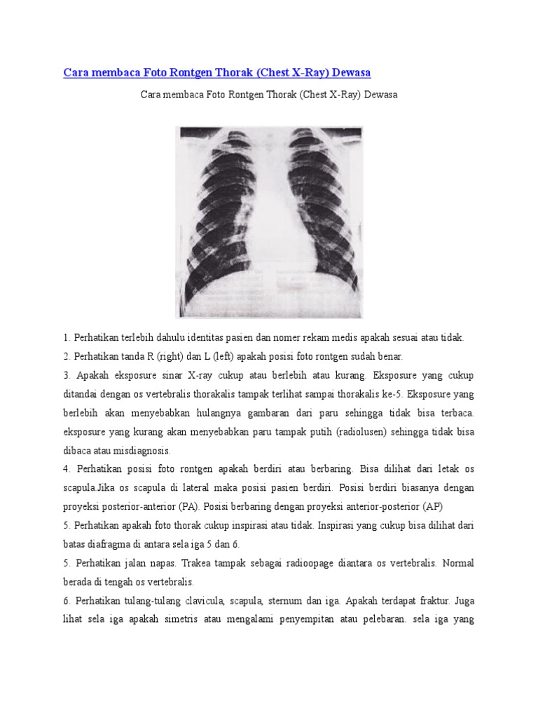 Cara Membaca Foto Rontgen Thorak | PDF