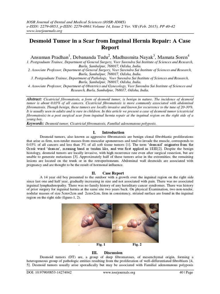 Desmoid Tumor in A Scar From Inguinal Hernia Repair: A Case Report ...