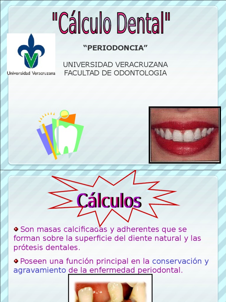 Calculo Dental | PDF | Diente humano | Ramas de Odontología