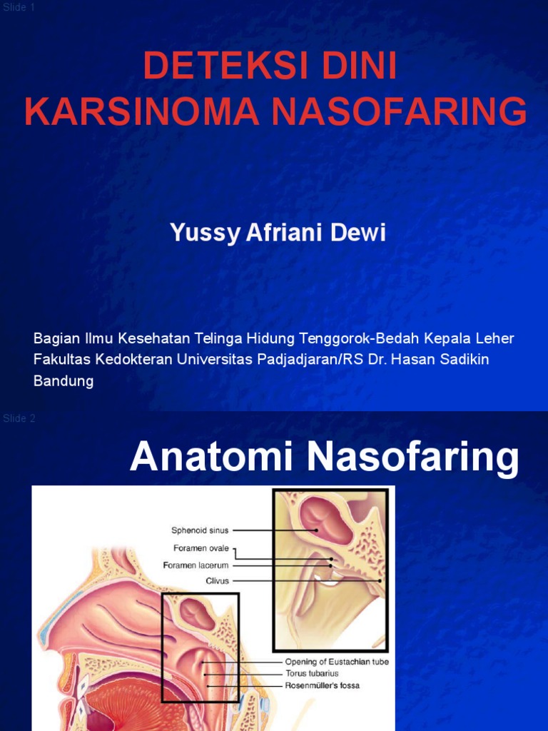 Karsinoma Nasofaring | PDF