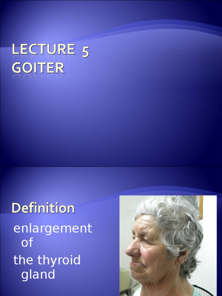 Lecture 5, Goiter | Download Free PDF | Hypothyroidism | Thyroid