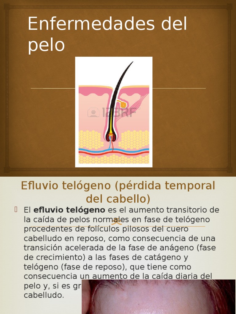 Enfermedades Del Pelo | PDF | Medicina | Medicina CLINICA