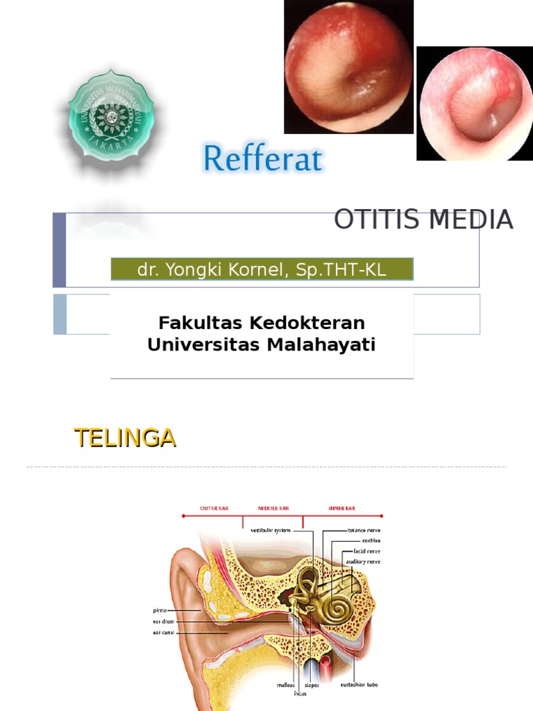 Referat Otitis Media | PDF