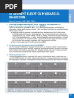ECG Case Studies Moosa1. | PDF | Electrocardiography | Cardiovascular ...