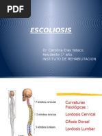 Signo de Risser | PDF | Escoliosis | Rtt