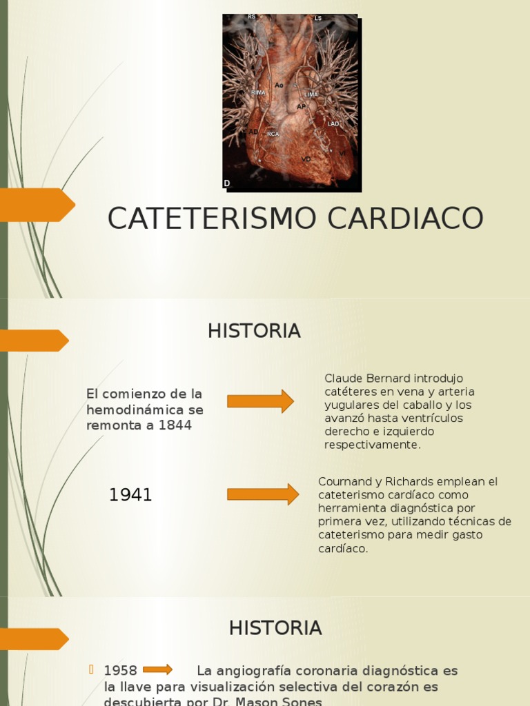 cateterismo cardiaco | Corazón | Stent