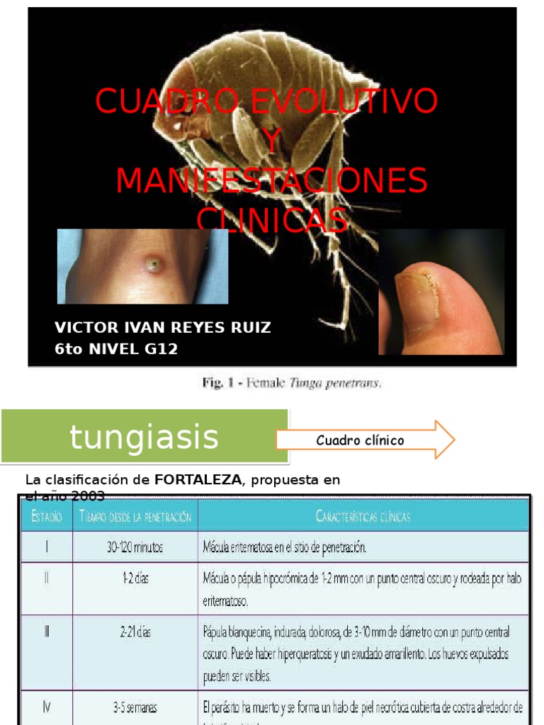 Tungiasis 2 | PDF