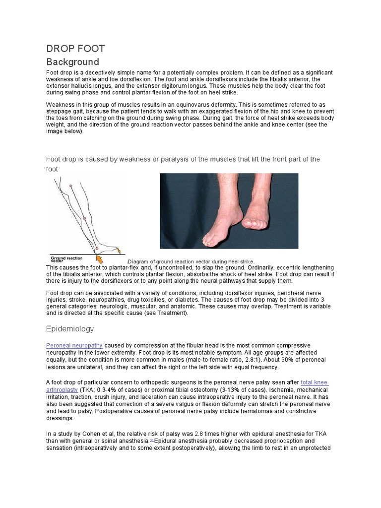 Drop Claw Foot | PDF | Foot | Neurology