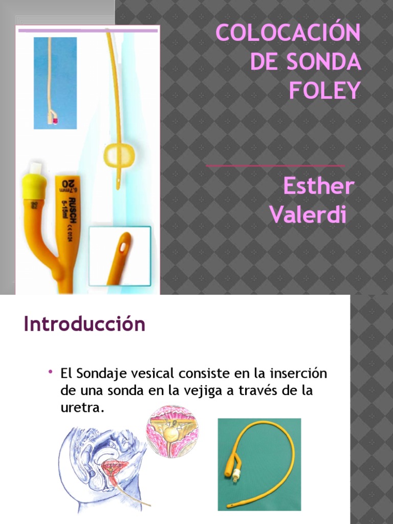 Foley | PDF | Vejiga urinaria | Sistema urinario