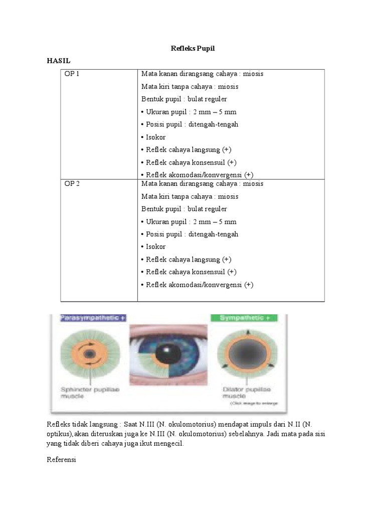 Refleks Pupil | PDF | Sains & Matematika