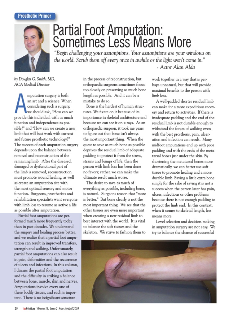 Partial Foot Amputation: Sometimes Less Means More | PDF | Amputation ...