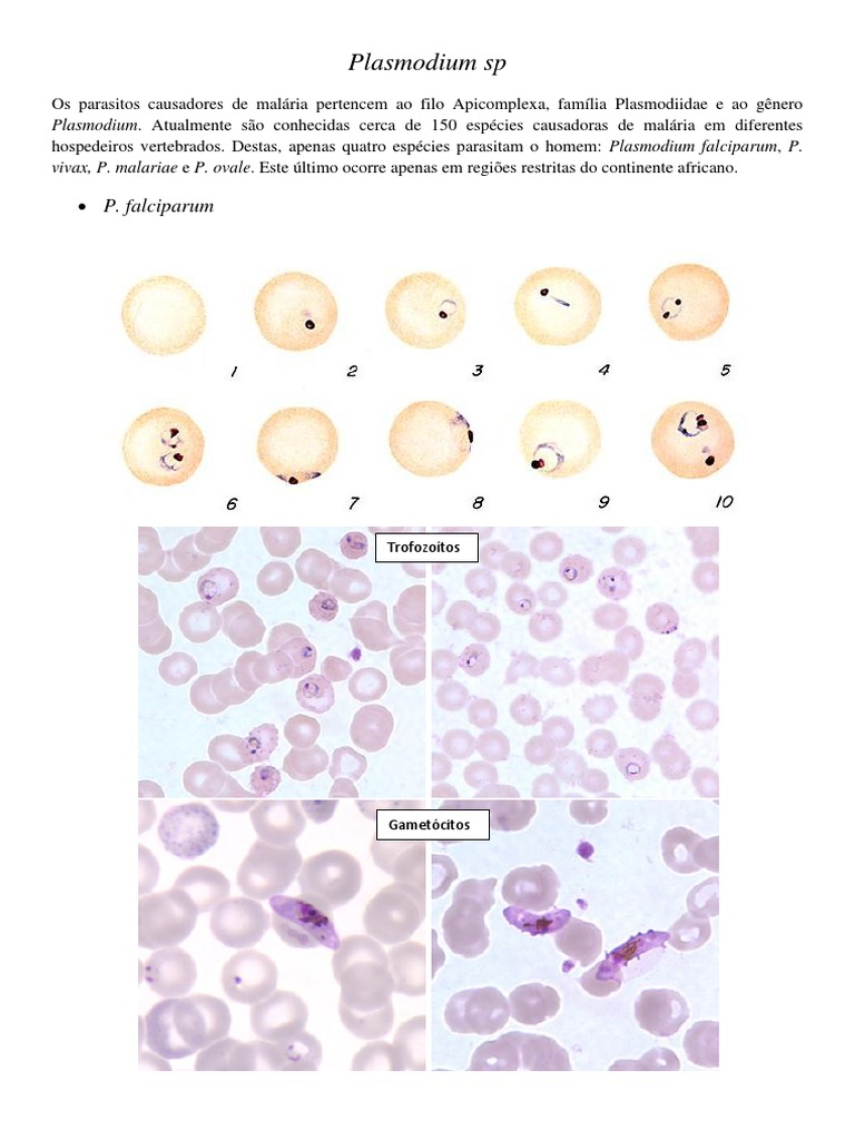 Plasmodium Sp