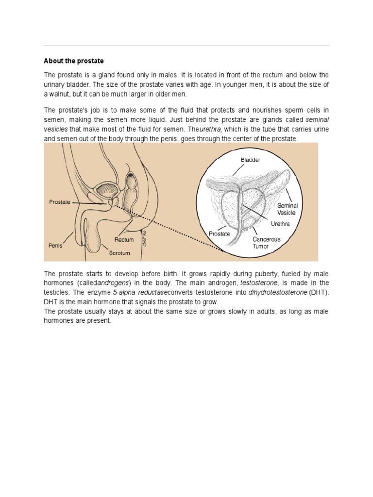 Prostate Cancer Staging Explained | PDF | Prostate Cancer | Prostate
