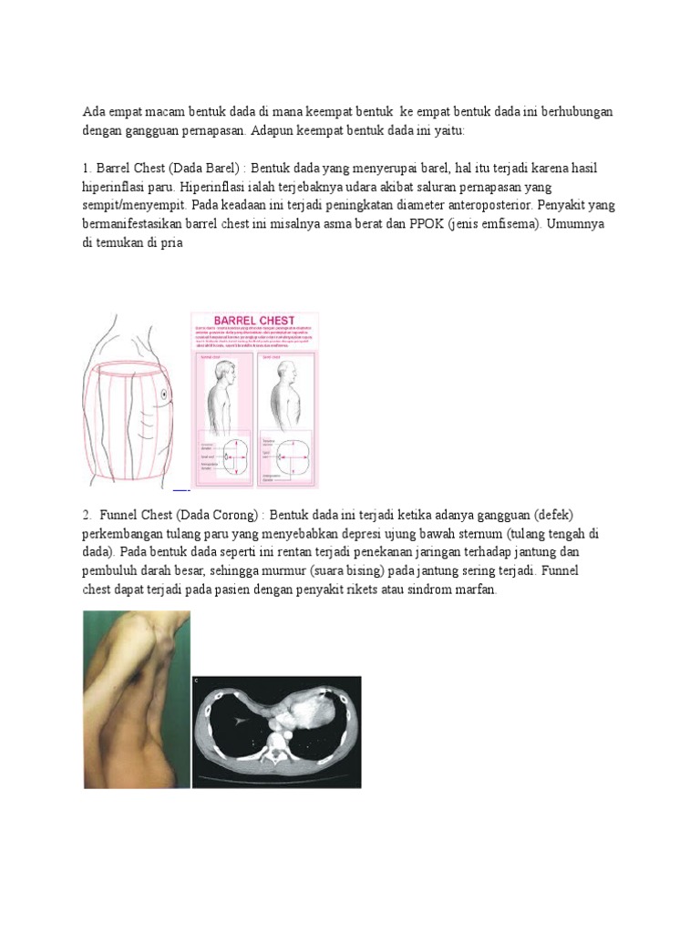 Bentuk Dada | PDF | Kesehatan Holistik