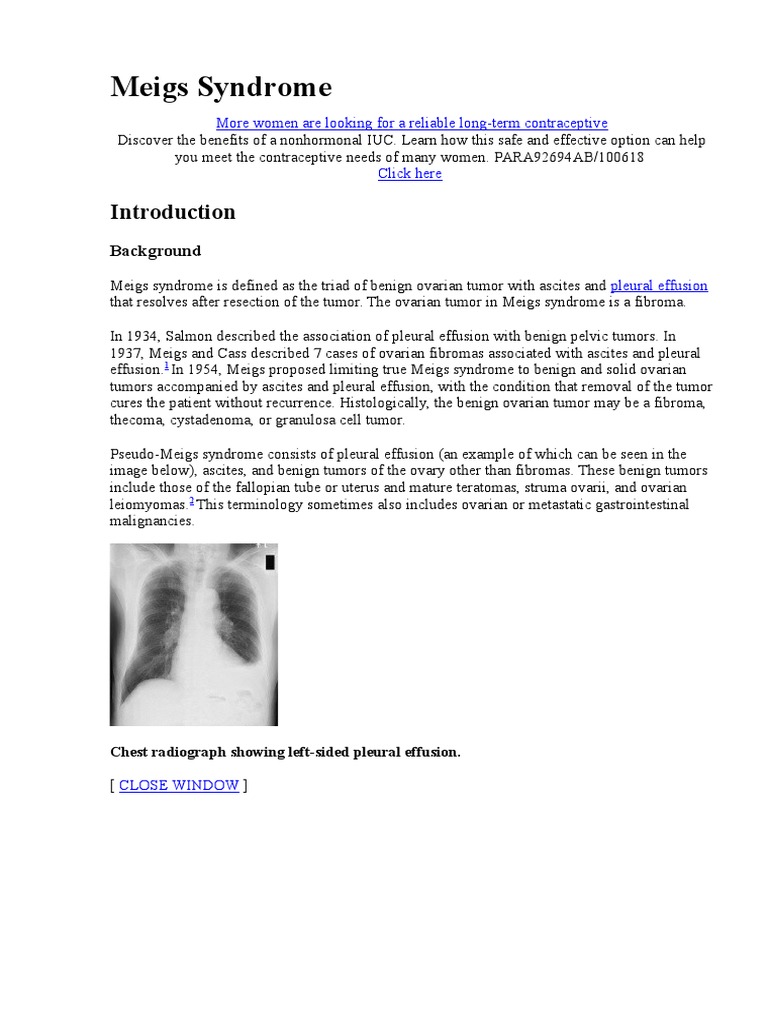 Meigs Syndrome: A Guide to the Clinical Presentation, Workup, and ...
