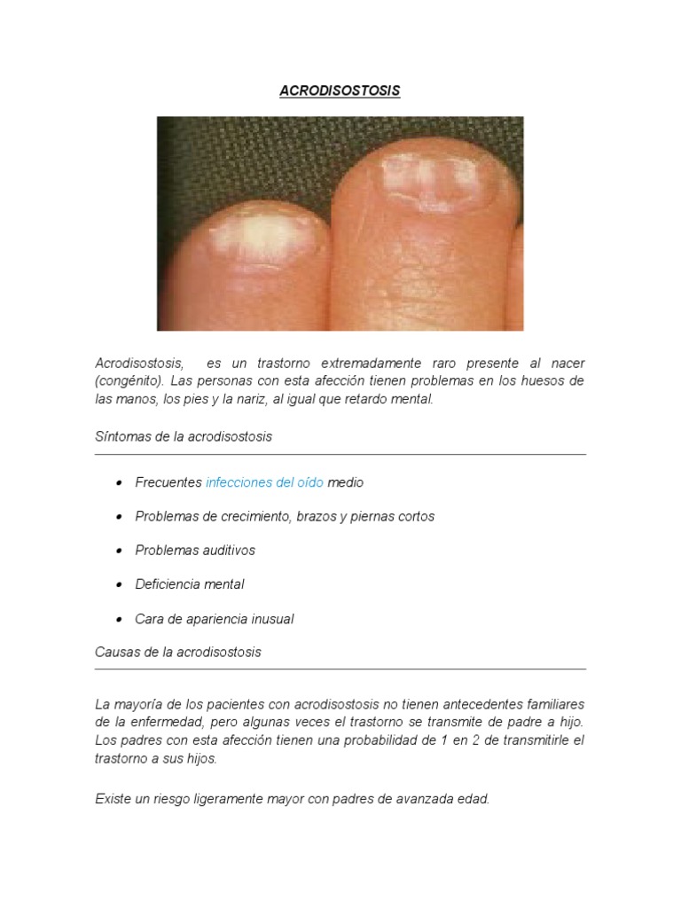 Acrodisostosis y sus implicaciones ungueales | PDF | Clavo (anatomía ...