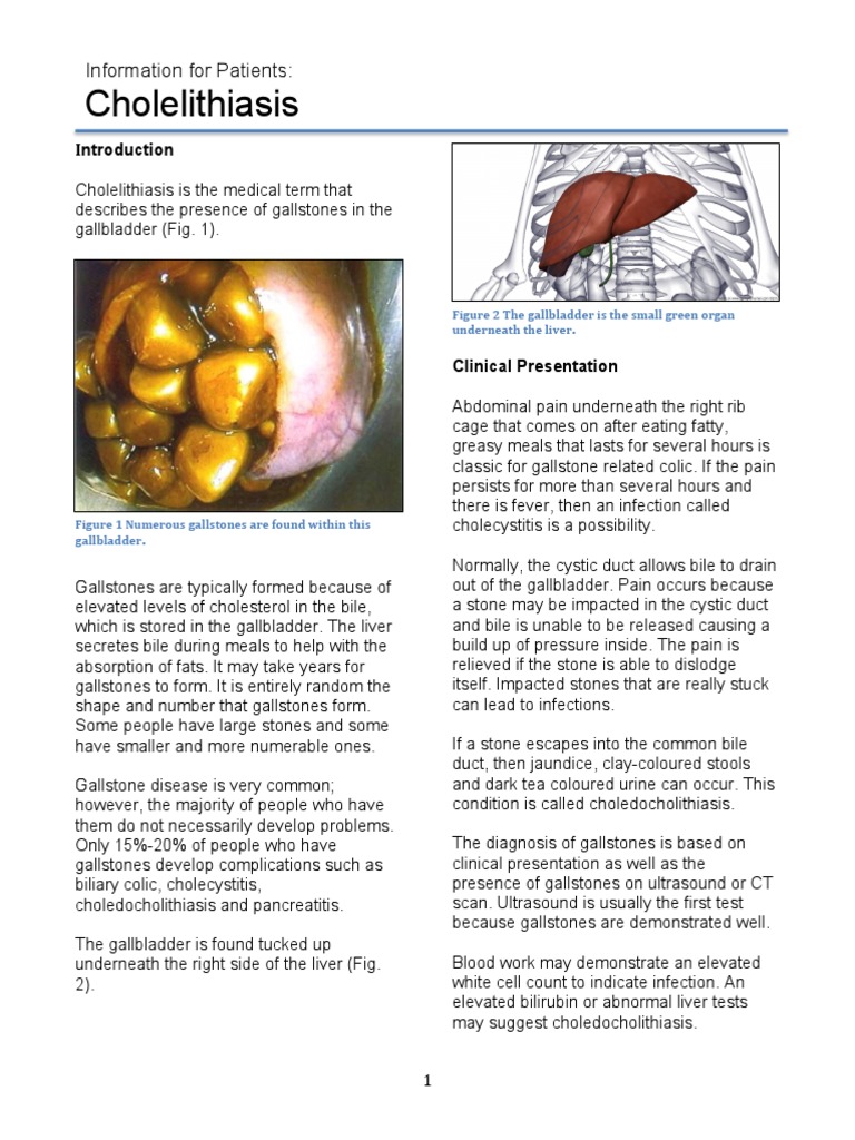 Cholelithiasis: Information For Patients | PDF | Gallbladder | Exocrine ...