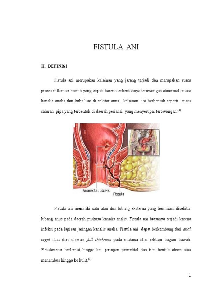 Definisi dan Klasifikasi Fistula Ani | PDF | Ilmu Sosial