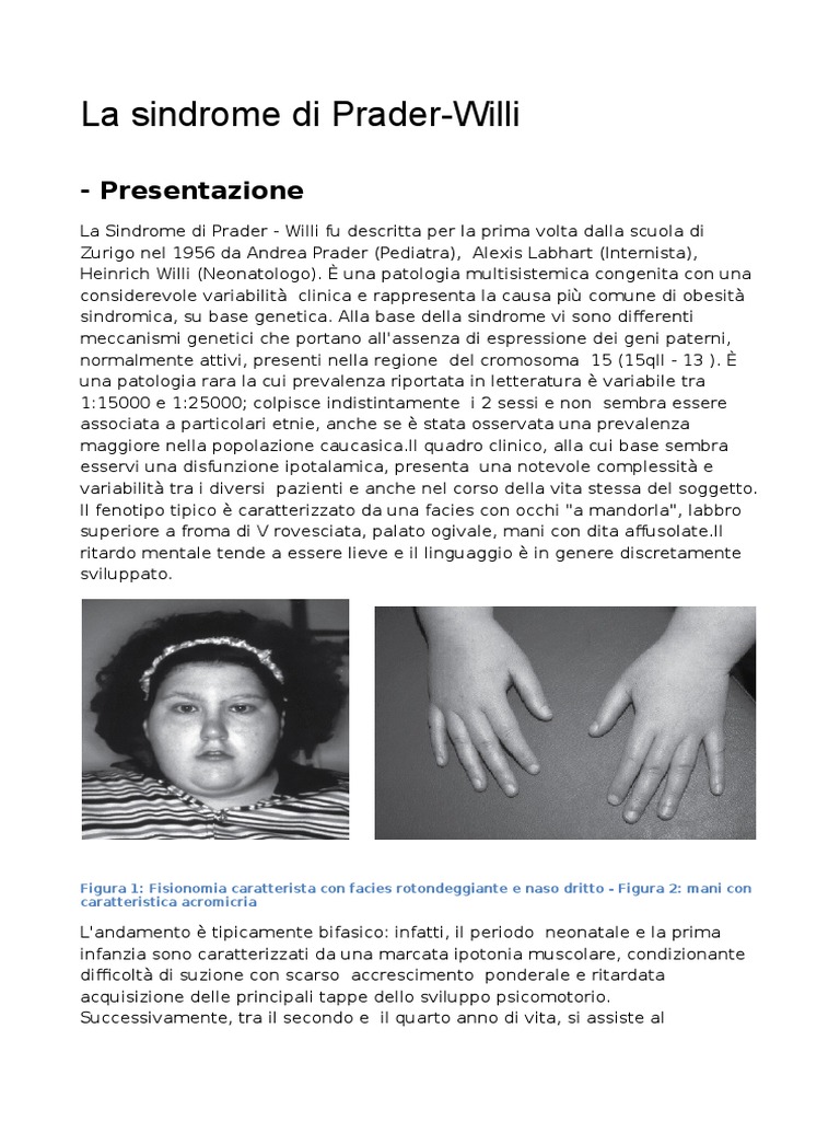 Cariotipo Da Sindrome De Prader Willi Diagnóstico Genético Por CGH E