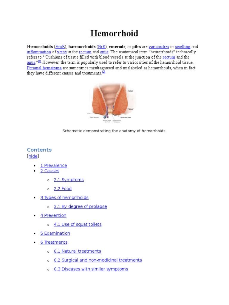 Hemorrhoid | PDF | Hemorrhoid | Thrombosis
