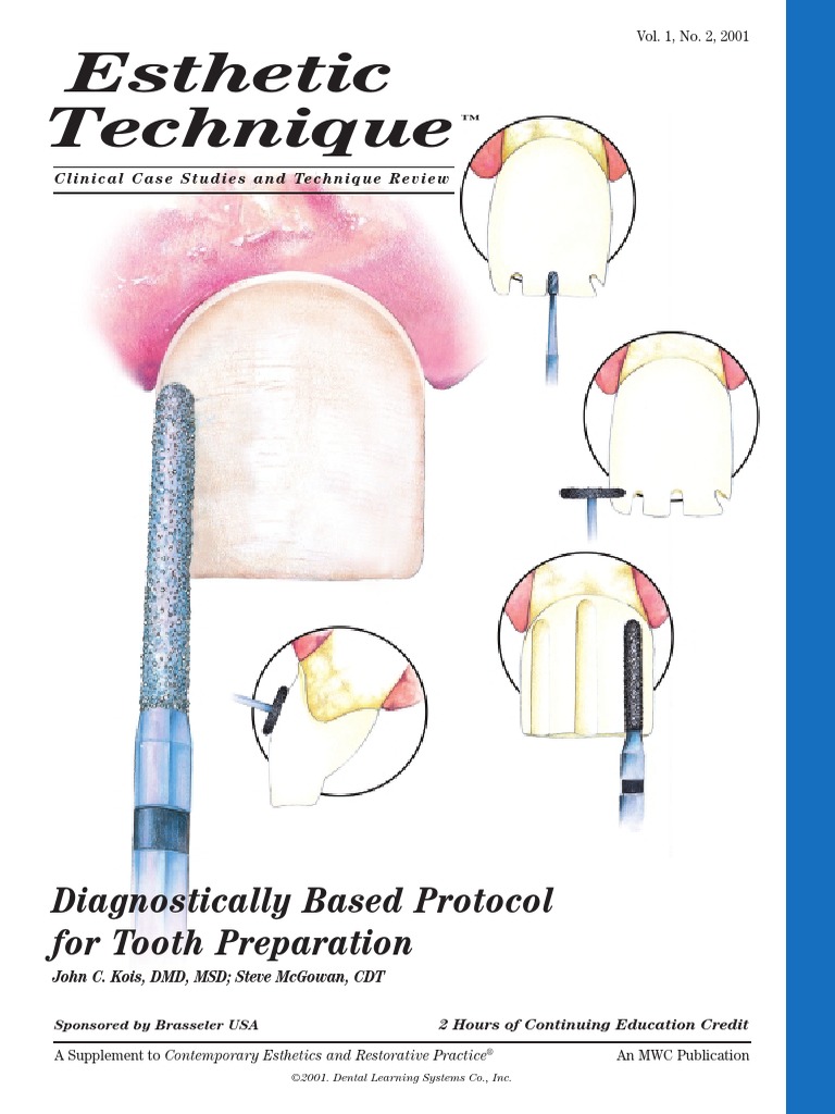 Kois DS | PDF | Dental Implant | Tooth Enamel