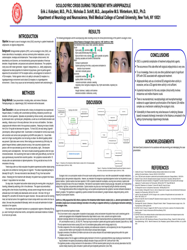 Oculogyric Crisis During Treatment With Aripiprazole | PDF ...