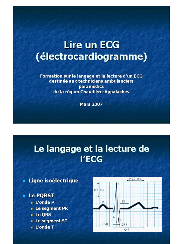 Lire Un ECG | PDF | Électrocardiographie | Cœur