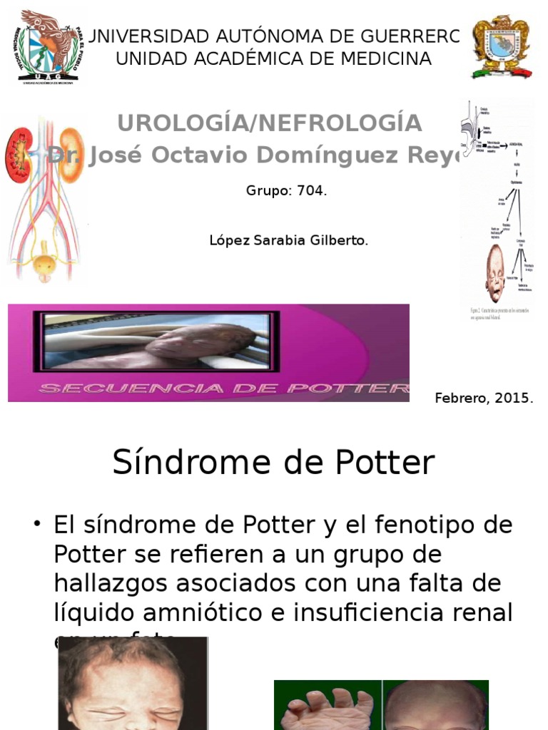 Características del Síndrome de Potter | PDF
