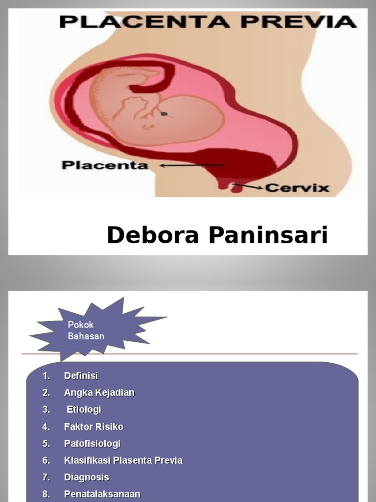 Plasenta Previa | PDF
