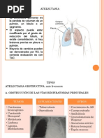 Reflejo o Triada D Cushing | PDF | Hipertensión | Anatomía humana