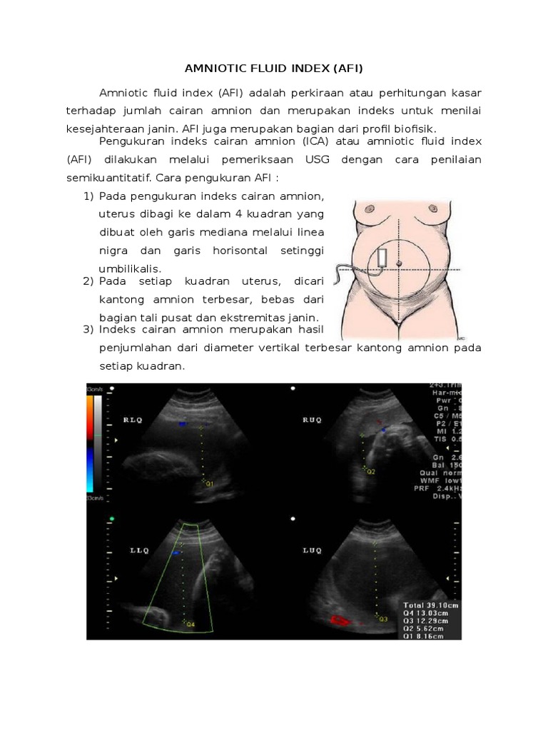 Indeks Cairan Amnion | PDF