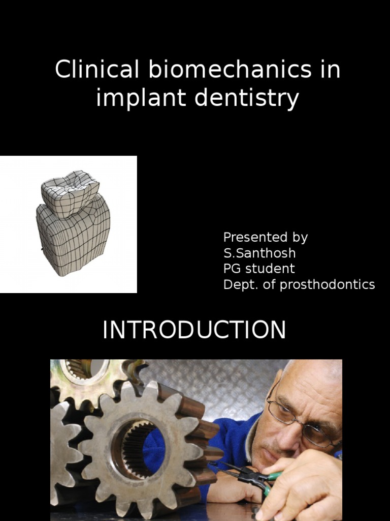 Clinical Biomechanics in Implant Dentistry | PDF | Dental Implant ...
