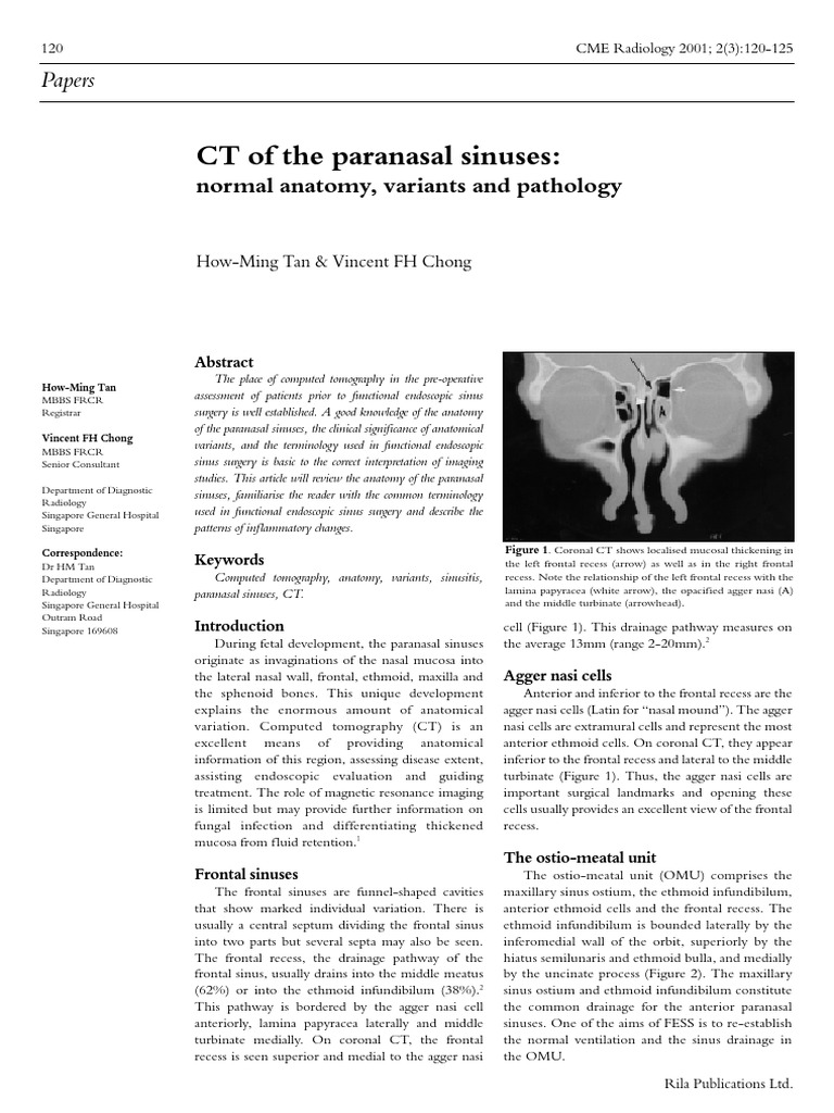 OMU Patterns in Sinusitis Imaging | PDF | Human Head And Neck | Medicine
