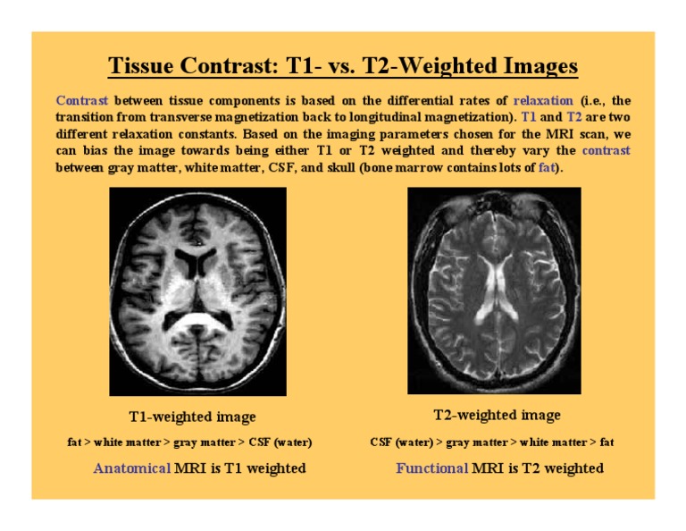 MRI T1 Imaging Vs T2 Imaging | PDF