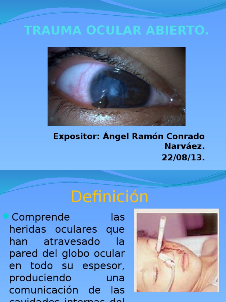 Trauma Ocular Abierto | PDF | Lesión | Ojo humano