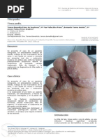 Onicectomía: Procedimiento y Cuidados | PDF | Clavo (anatomía) | Dedo ...