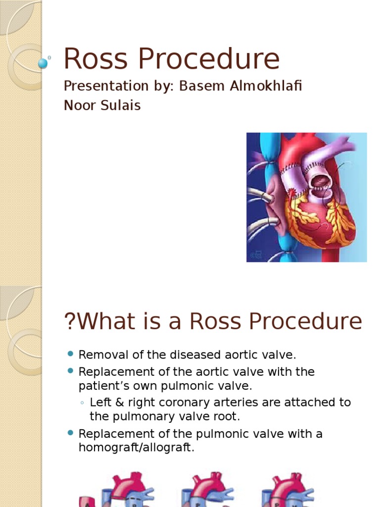 Ros Procedure | PDF | Heart Valve | Aorta
