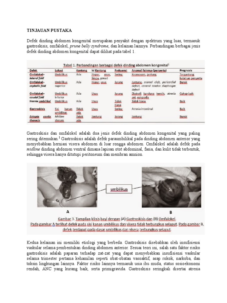 Gastroskizis Dan Omfalokel | PDF