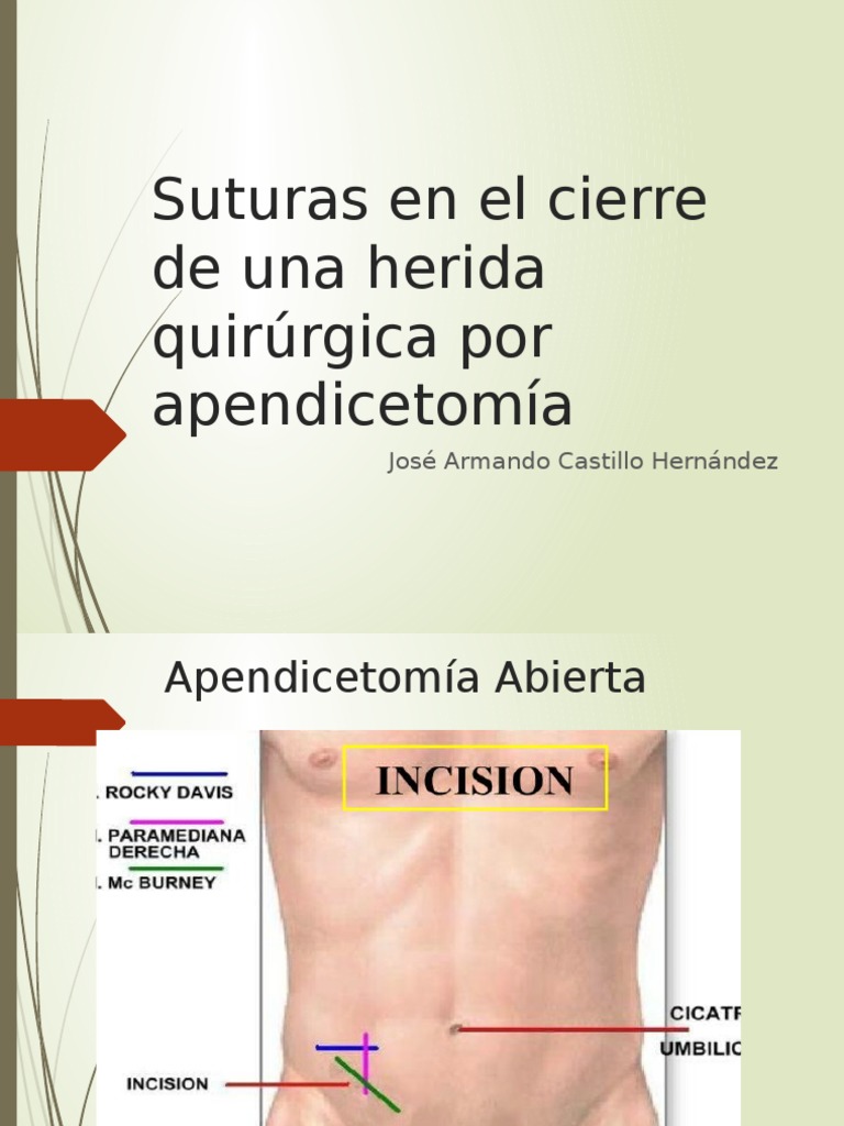 Suturas en El Cierre de Una Herida Quirurgica | Cirugía ...