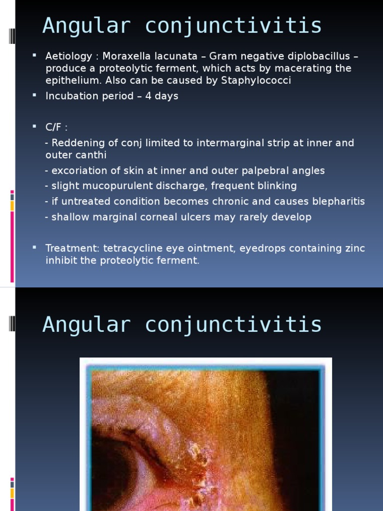 Angular Blepharoconjunctivitis