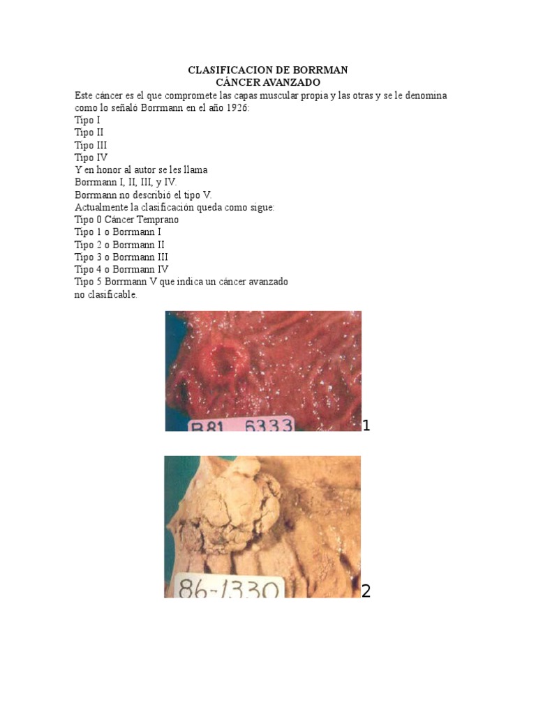 Clasificacion de Borrman | PDF