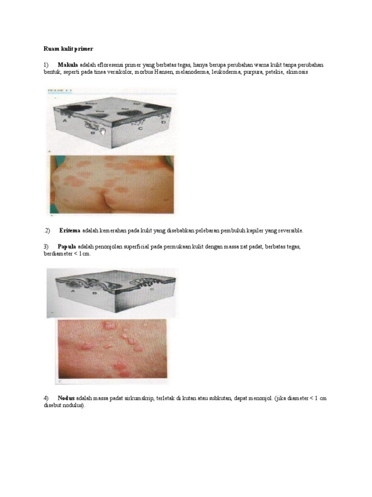Ruam Kulit Primer | PDF