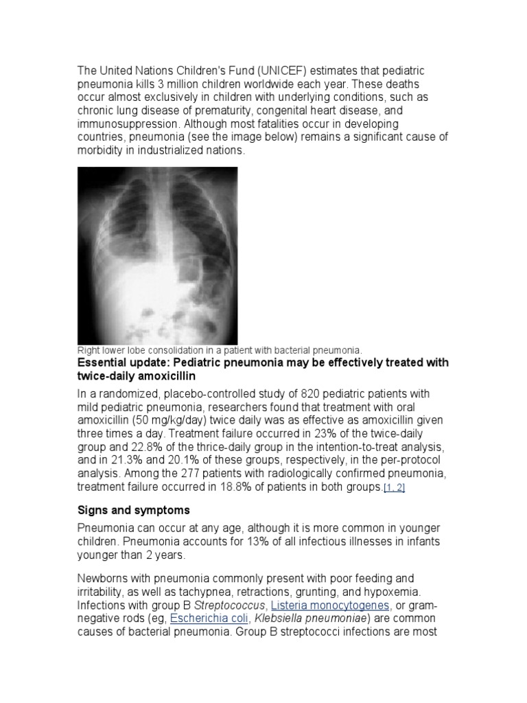Pnemonia Medscape | PDF | Pneumonia | Respiratory Tract