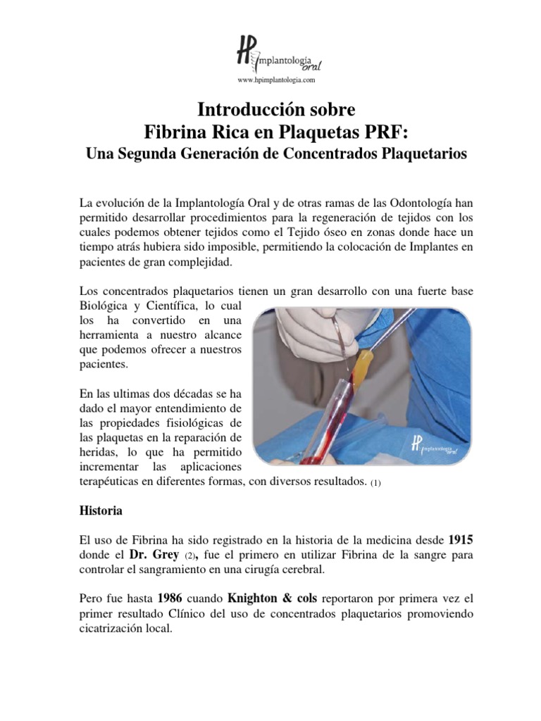 Introduccion Sobre Fibrina Rica en Plaquetas PRF PDF | PDF | Plaqueta ...