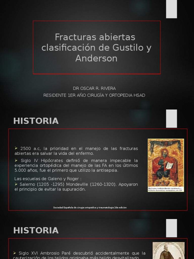 Fracturas Abiertas Gustilo y Anderson | PDF | Traumatologia | Herida