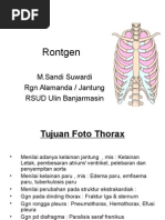 PDF Anatomi Thorax Normal Gambaran Radiologi Compress | PDF