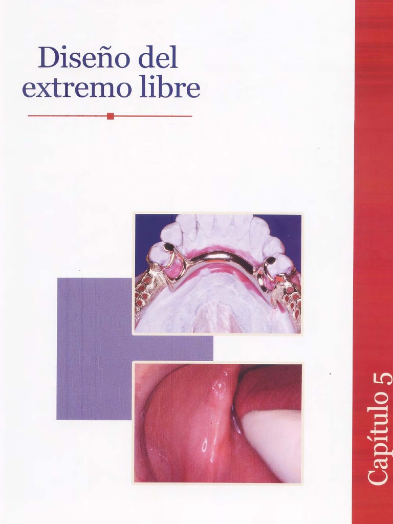 Extremo Libre Ppr1 | PDF