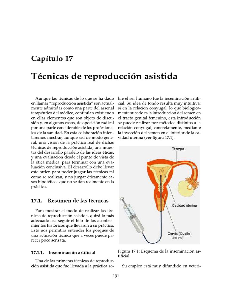 Tecnicas de Reproduccion Asistida | Descargar gratis PDF | Fertilización en vitro | Tecnología ...