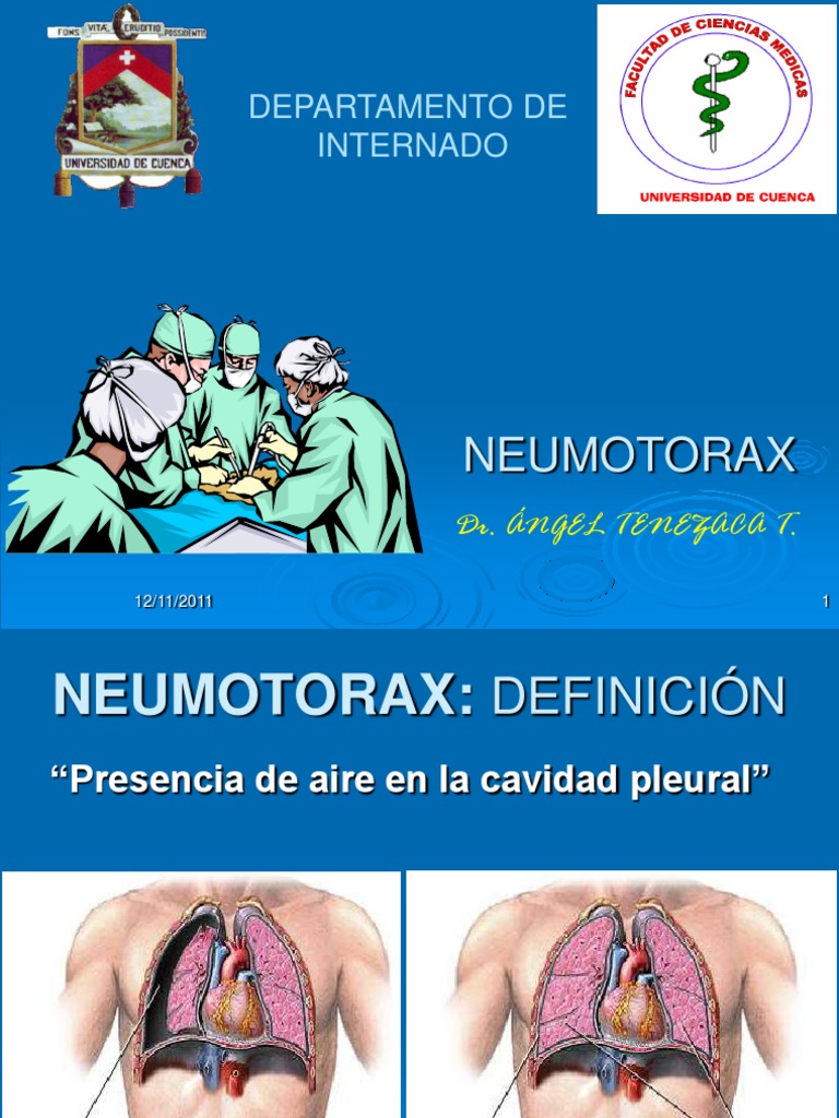 Neumotórax: Definición y Tratamiento | PDF | Lesión | Pulmón