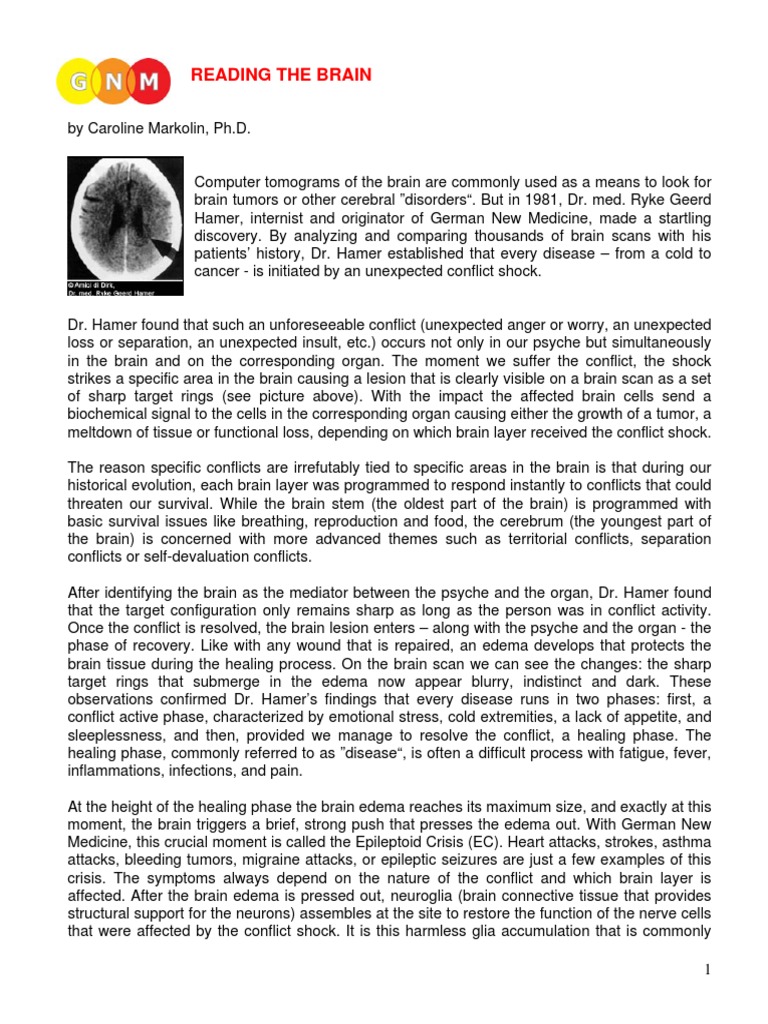 Reading The Brain by Caroline Markolin | PDF | Brain | Epilepsy